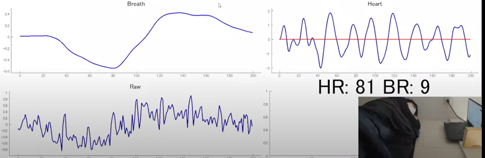 PSoC™6 and XENSIV Radar Machine Learning-based Human Detection ...