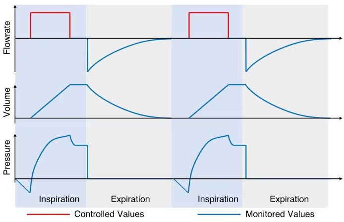 OpenVent open-source 3D printable ventilator - Infineon Developer Community